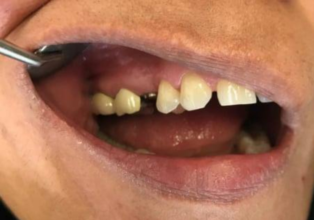 Archie Dental - General Dentistry & Cosmetic Dentistry